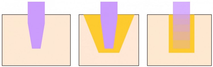 SmaXel multi-functional fractional CO2 laser by IDS laser